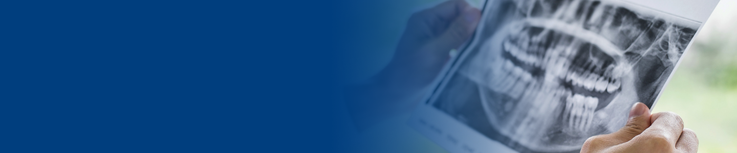 Resources | Fairfax, VA Fairfax Oral & Maxillofacial Surgery